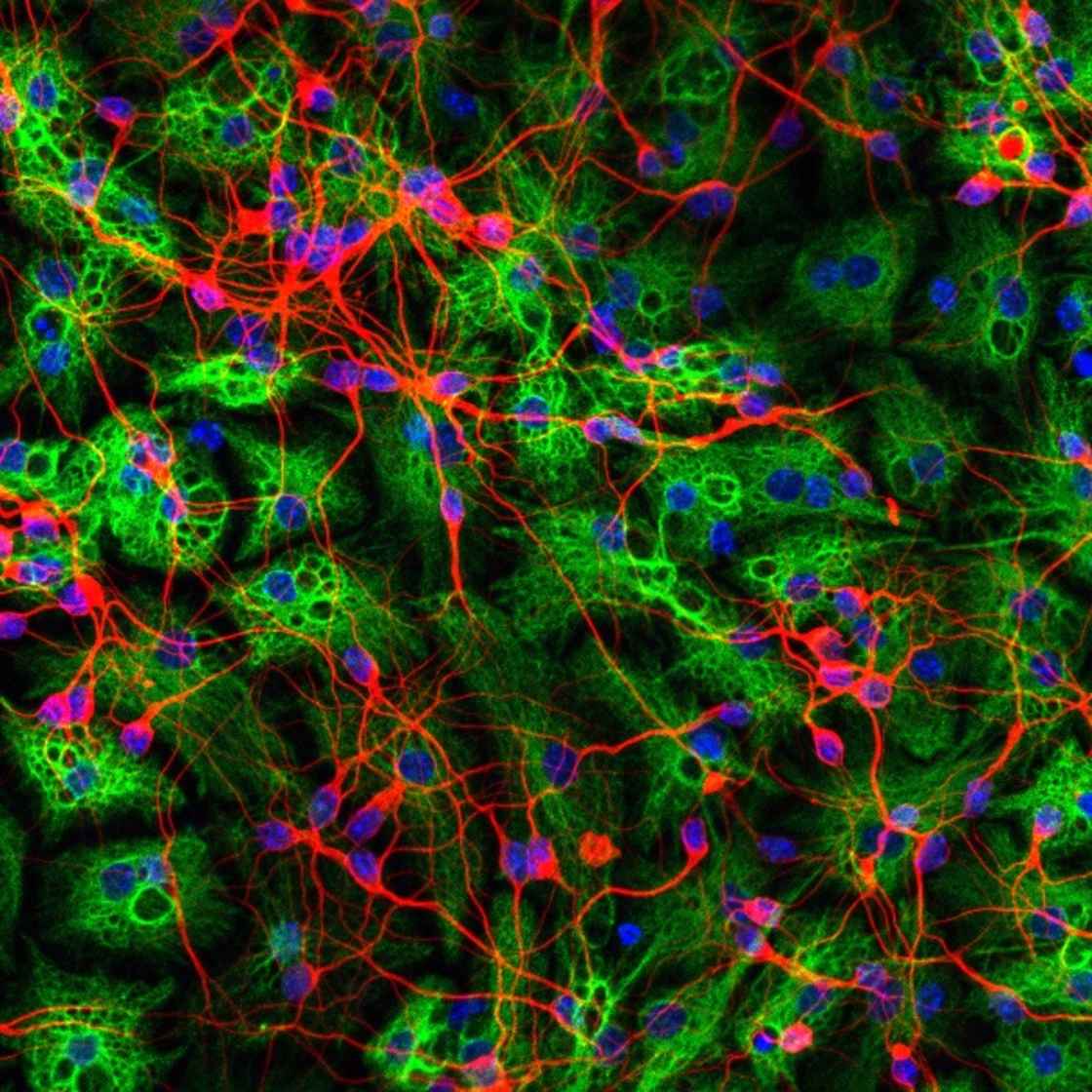 The Croucher Foundation