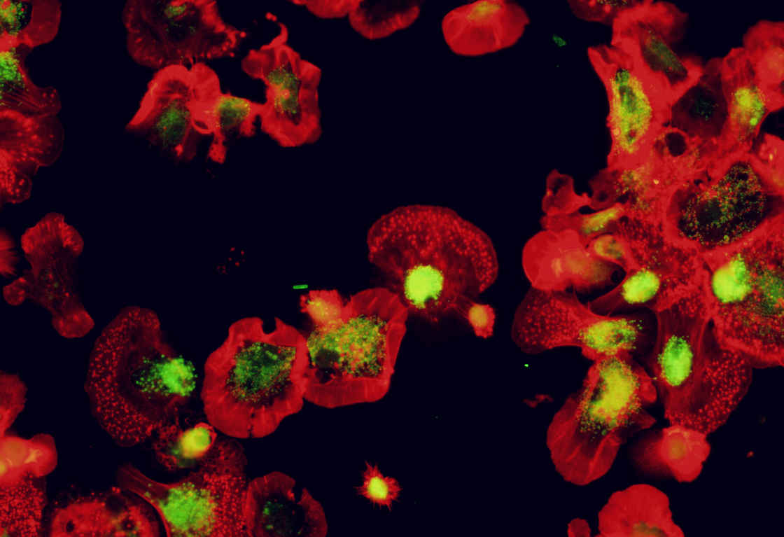 The Croucher Foundation